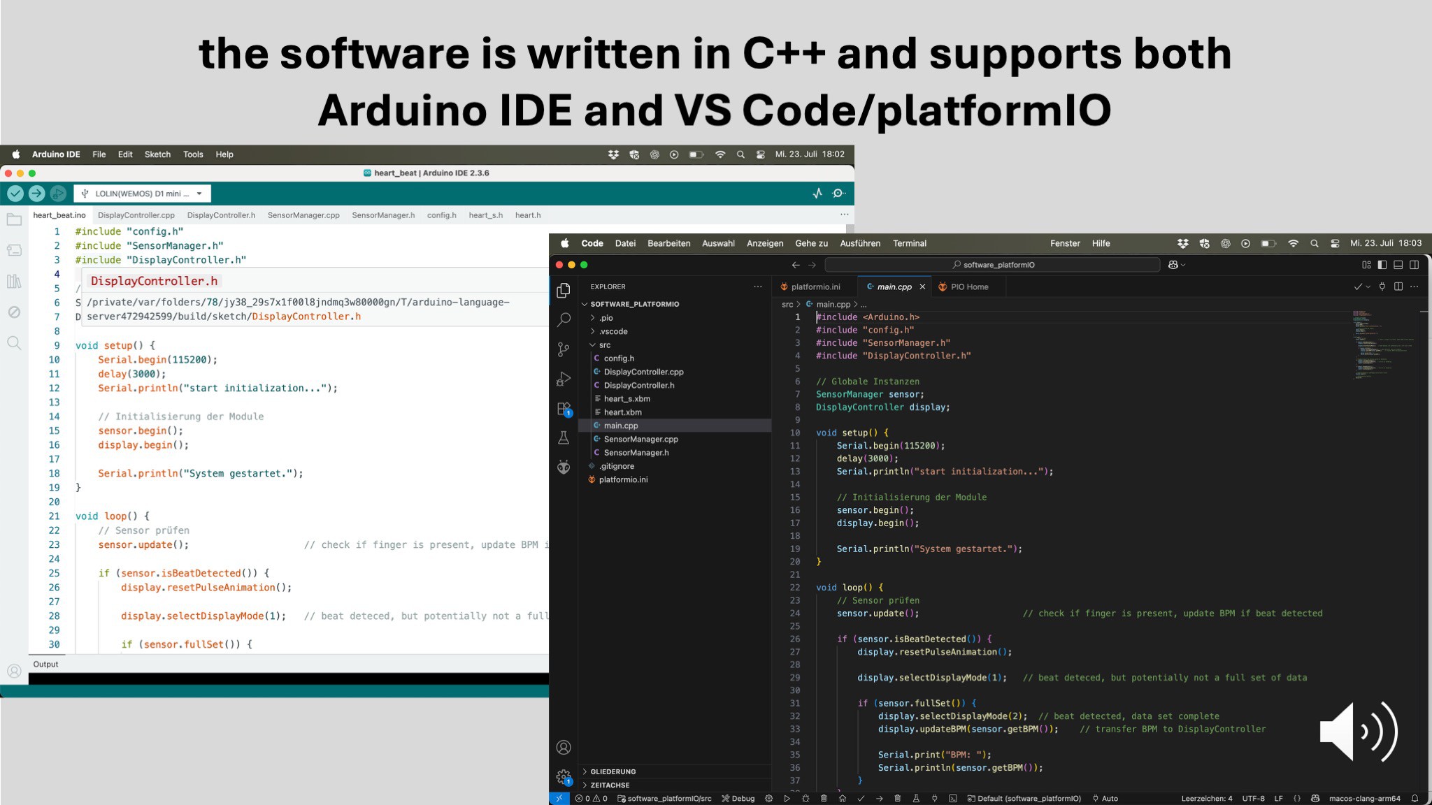 One Hertz, One Beat –DIY Arduino Heart Rate Sensor | Details | Hackaday.io