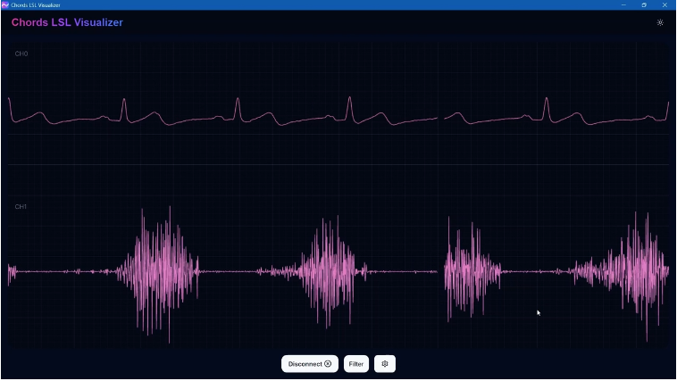 Neuro PlayGround (NPG) Lite | Details | Hackaday.io