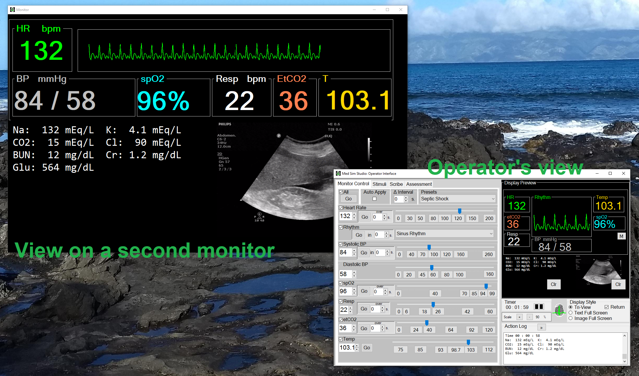 Gallery | Med Sim Studio: A free medical simulation platform | Hackaday.io