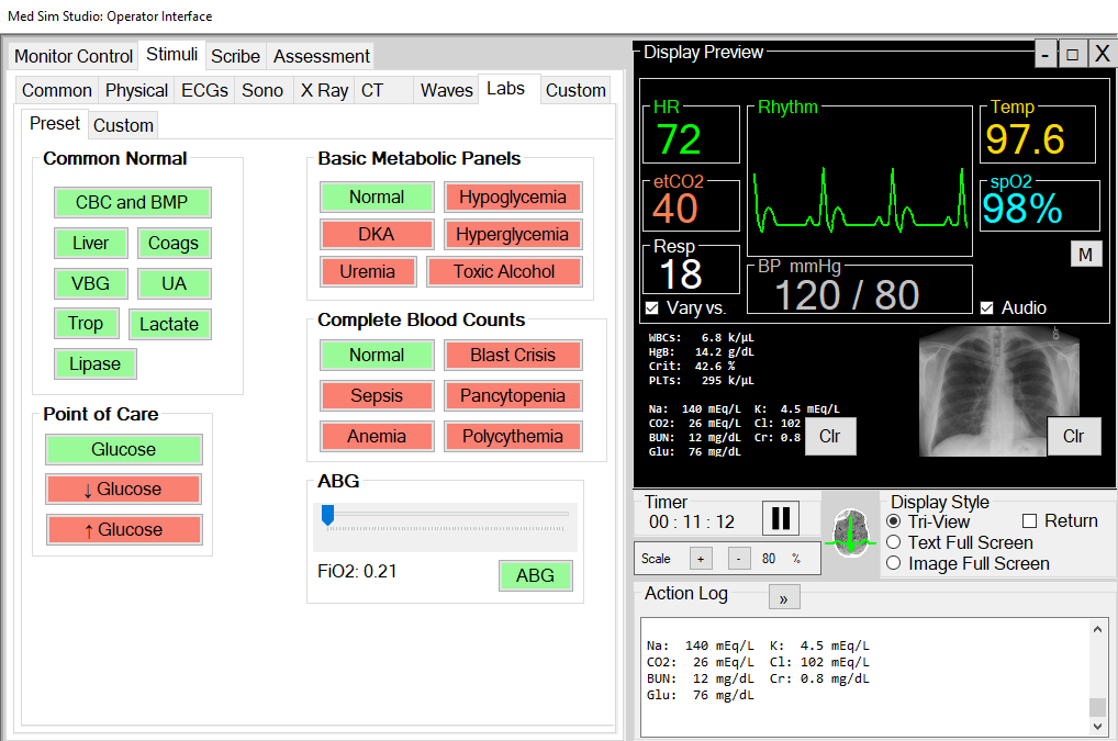 Gallery | Med Sim Studio: A free medical simulation platform | Hackaday.io