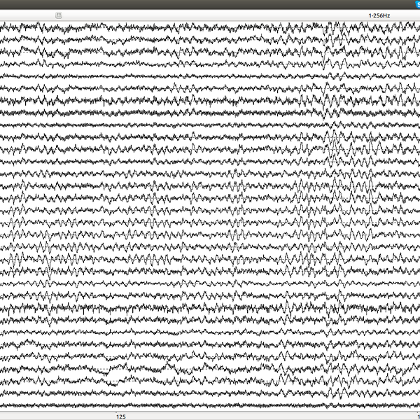 FreeEEG32 beta (alpha1.5) | Hackaday.io