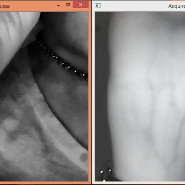 YET Another IR Vein Detector | Hackaday.io