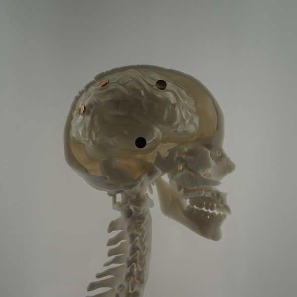 Illuminated Brain | Hackaday.io