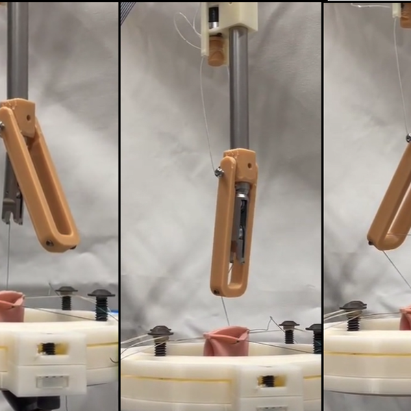 STAR Autonomous Suture Tension Management Device | Hackaday.io