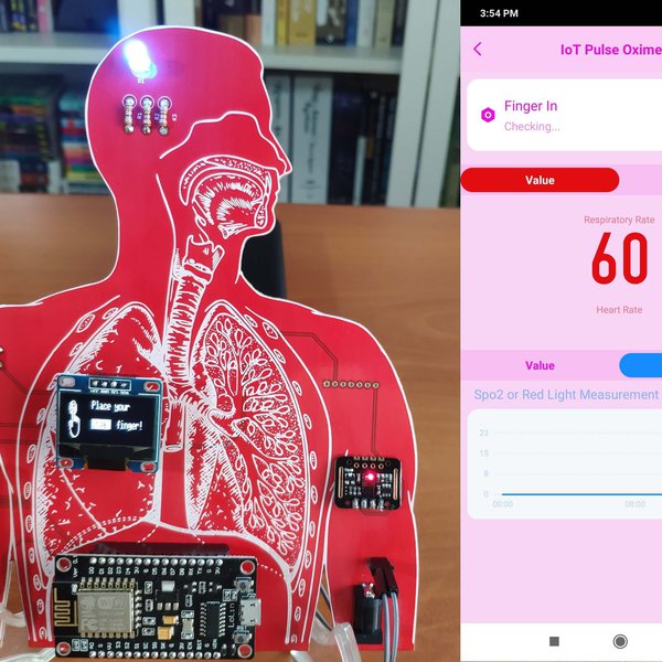 IoT Heart Rate (BPM) Monitor and Tracker | Hackaday.io IoT Heart Rate (BPM) Monitor and Tracker | Hackaday.io