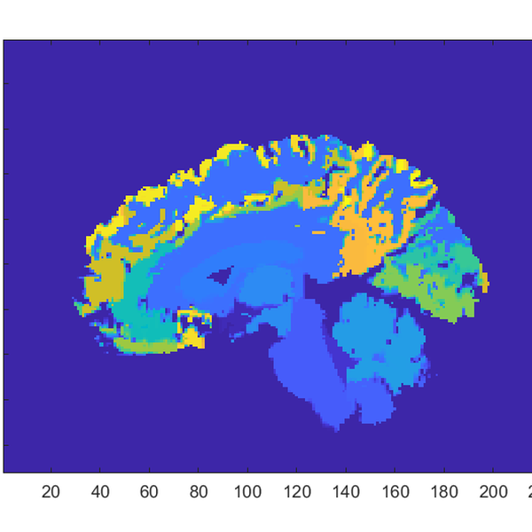 Deep Learning Brain Age Estimation | Hackaday.io