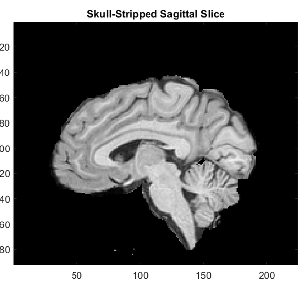 Deep Learning Brain Age Estimation | Hackaday.io