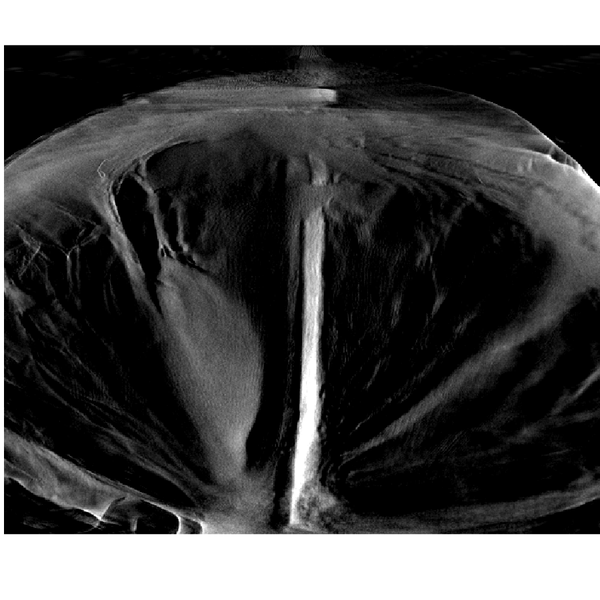 Desktop CT and 3D scanner with Arduino | Hackaday.io