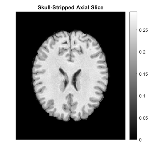 Deep Learning Brain Age Estimation | Hackaday.io
