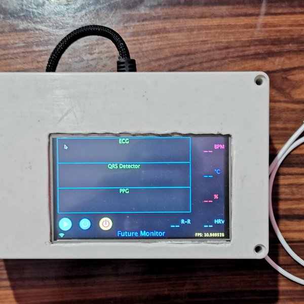 Remote Patient Monitor System | Hackaday.io
