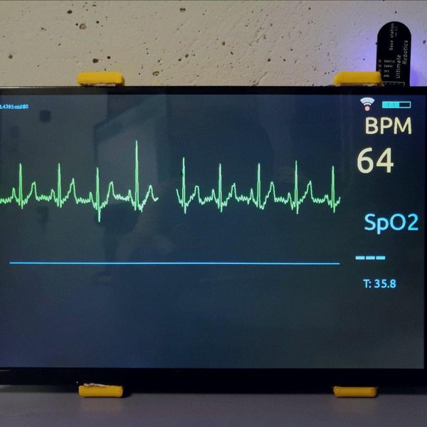 uDoc - open source patient monitor | Hackaday.io