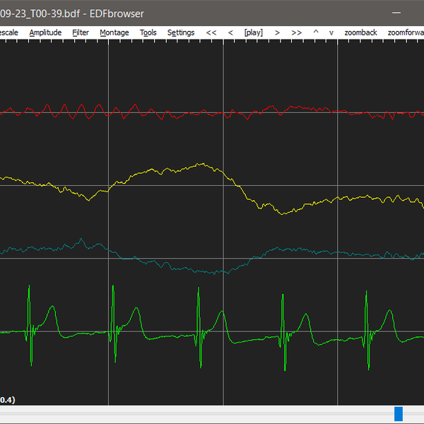 OpenLD: Lucid Dreaming Research Platform | Hackaday.io