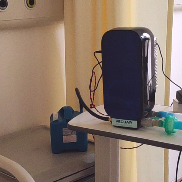 Low-cost advanced mode ventilator | Hackaday.io