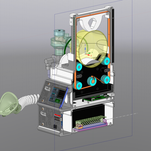 DP Ventilator | Hackaday.io