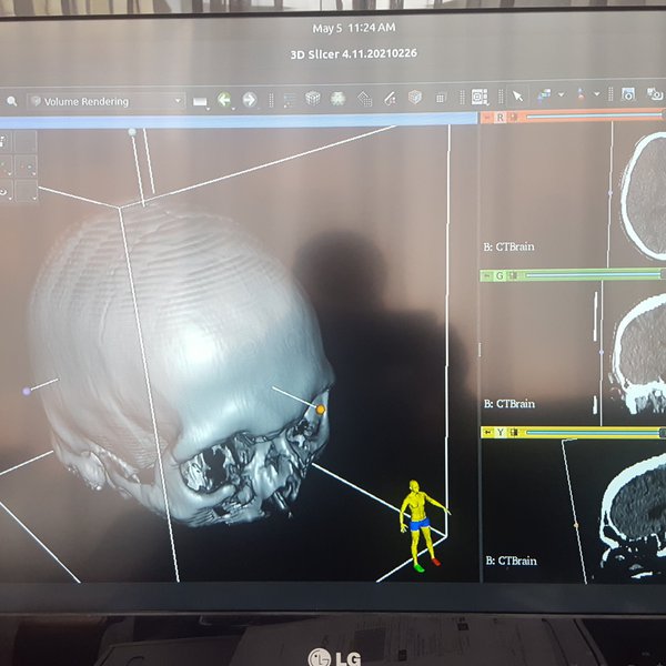 CT system Revamp | Hackaday.io