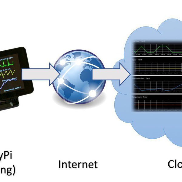 Connected Health: Open source IoT patient monitor | Hackaday.io