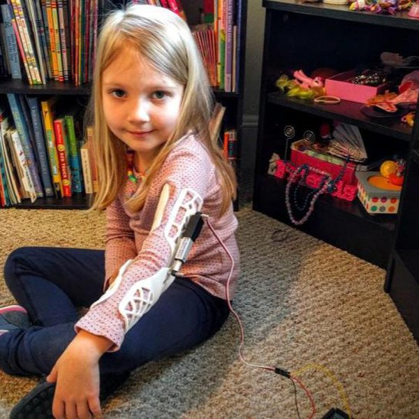 Building an Assistive Robotic Arm | Hackaday.io