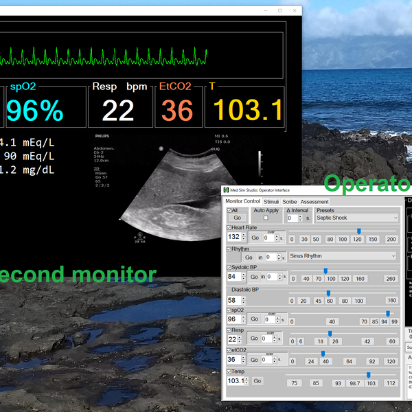 Med Sim Studio: A free medical simulation platform | Hackaday.io