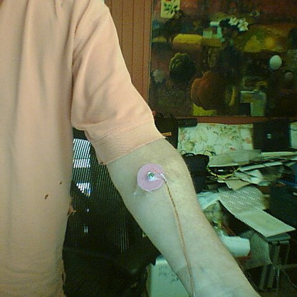 Acoustic Myography/Mechanomyography Experiments | Hackaday.io