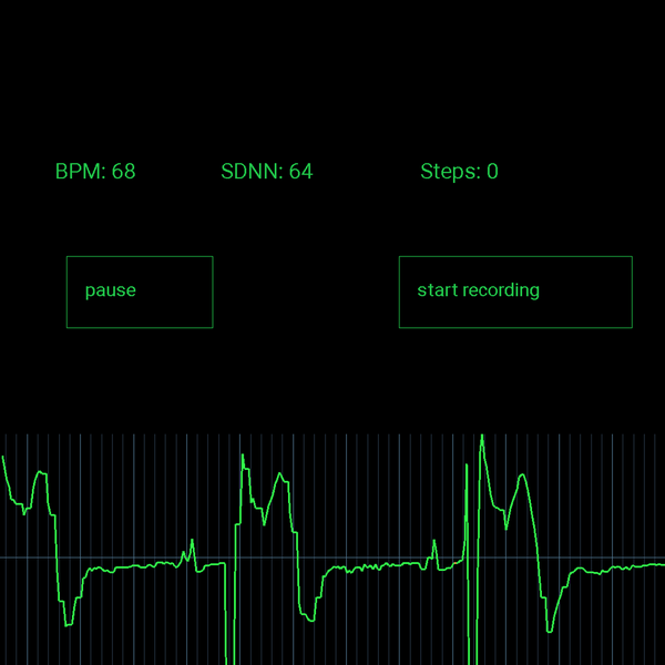 uECG - small open source wireless ECG sensor | Hackaday.io