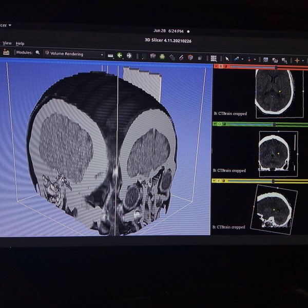 CT system Revamp | Hackaday.io
