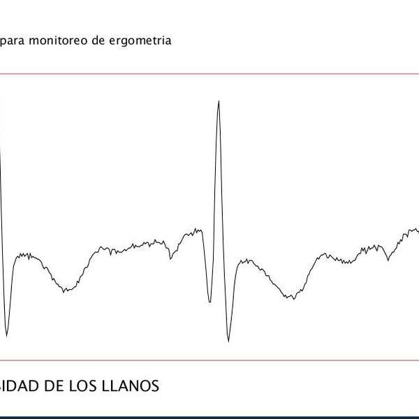 Portable ECG EKG 3.7V | Hackaday.io