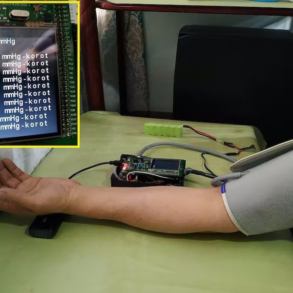 Digital Blood Pressure Monitor | Hackaday.io