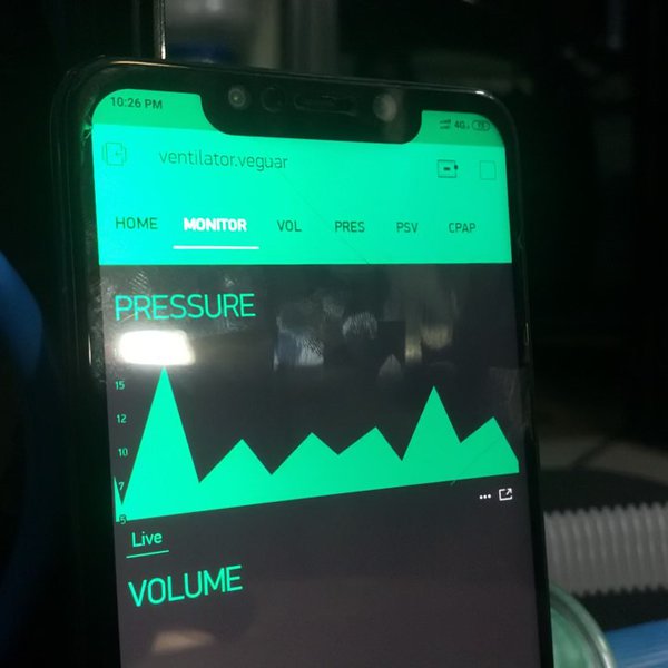 Low-cost advanced mode ventilator | Hackaday.io