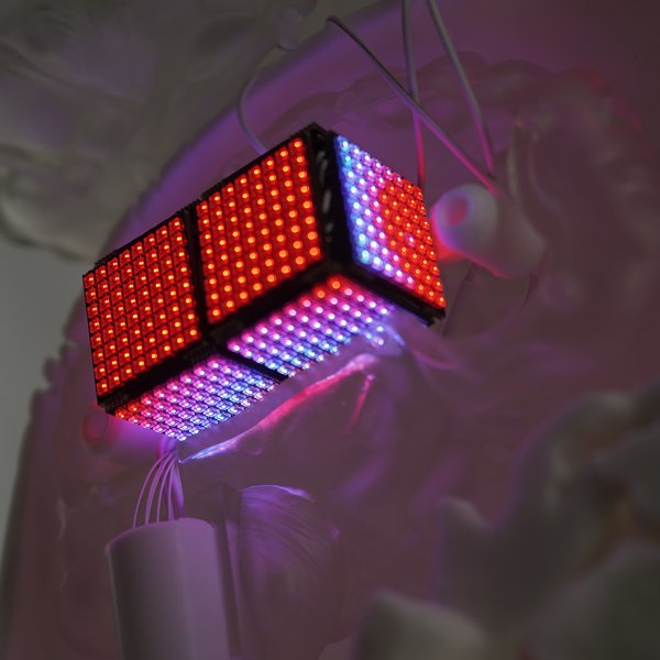 Illuminated Brain | Hackaday.io