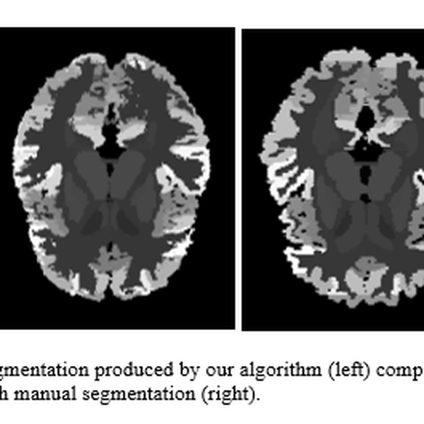 Deep Learning Brain Age Estimation | Hackaday.io